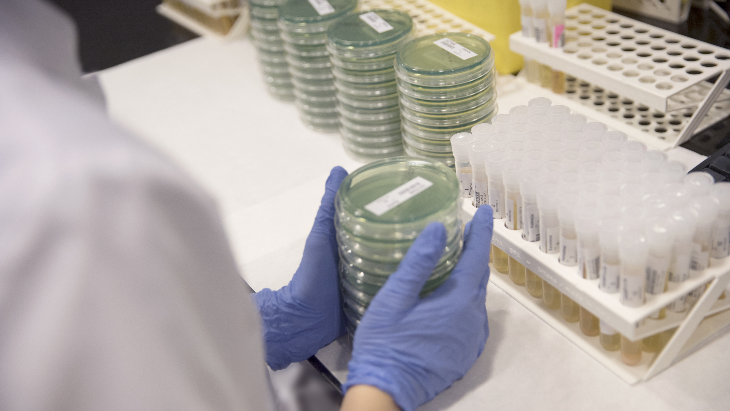 Perfiles | Laboratorio de análisis Echevarne